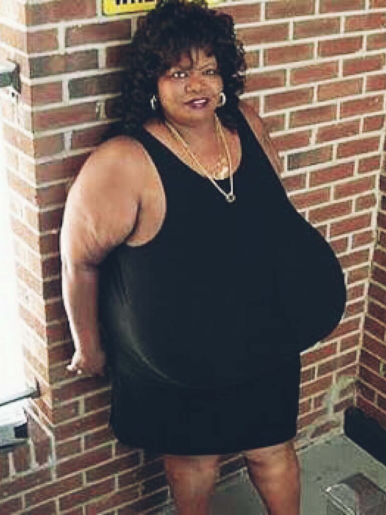 Annie Hawkins Meet The Woman With The Largest Natural Breasts In The